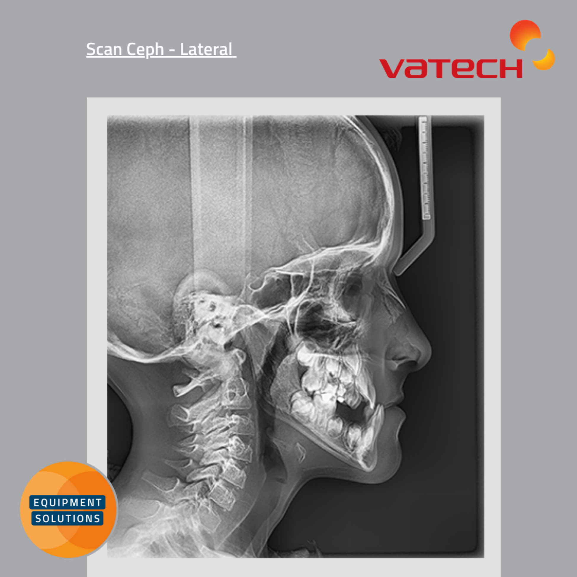 Vatech PaX-i Plus OPG | 2D Digital Imaging | Hague Dental Supplies