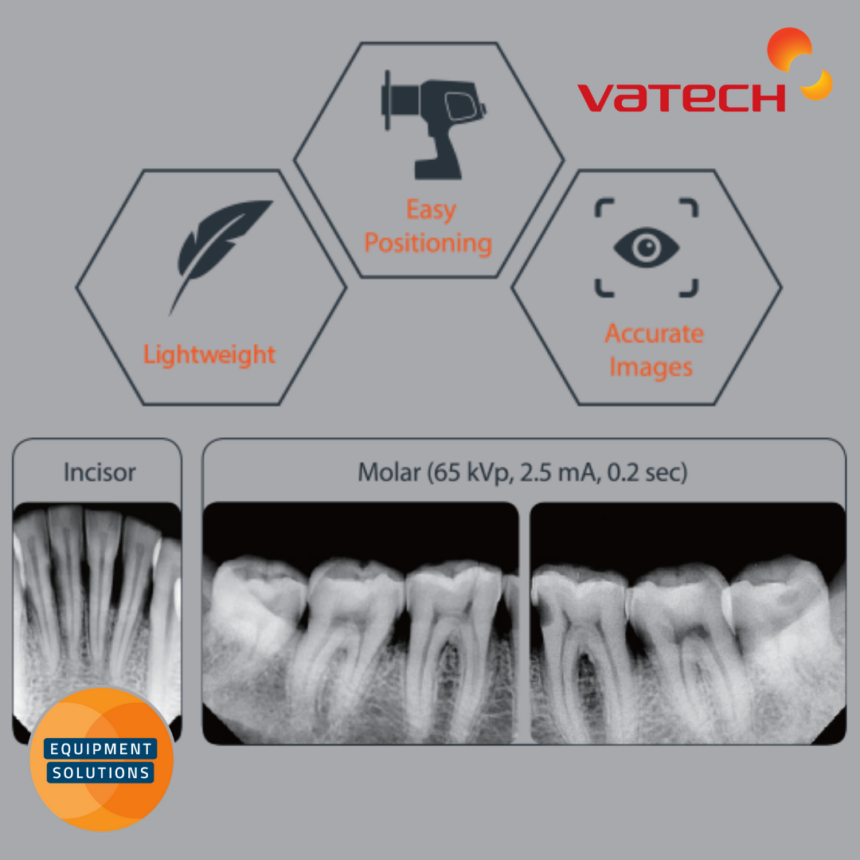 Vatech EzRay Air P Handheld X-Ray | Intraoral Imaging | Hague Dental ...