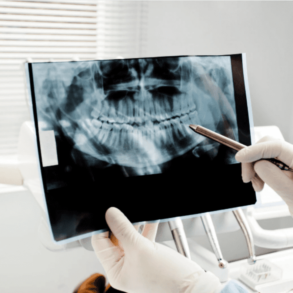 Intraoral X-Ray | Dental Diagnostics | Digital Dental Equipment